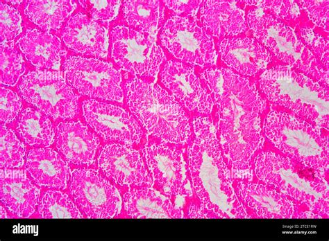 Human Testicle Or Testis Section Showing Seminiferous Tubules Leydig