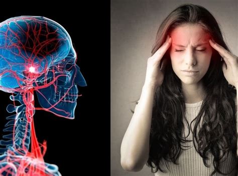 Un Derrame Te Avisa Un Mes Antes El Cuerpo Te Lo Advierte Por Medio