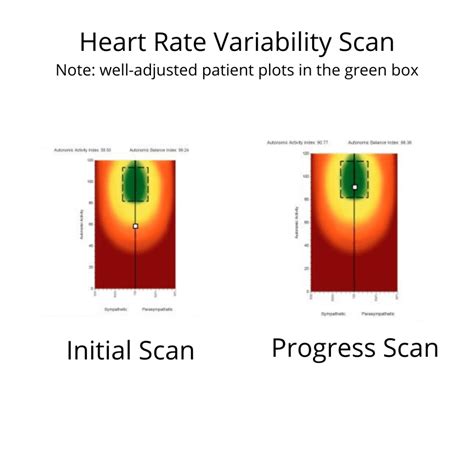 Heart Rate Variability Tips To Improve It Chiropractor
