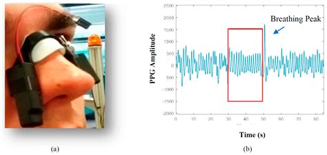 Sensors Free Full Text A New Wearable System For Home Sleep Apnea