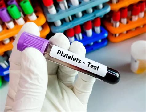 Platelet Count Diagnostic Plus