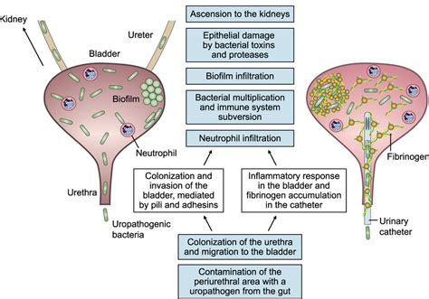 Colonization Of The Bladder By Uropathogenic Bacteria With And Without