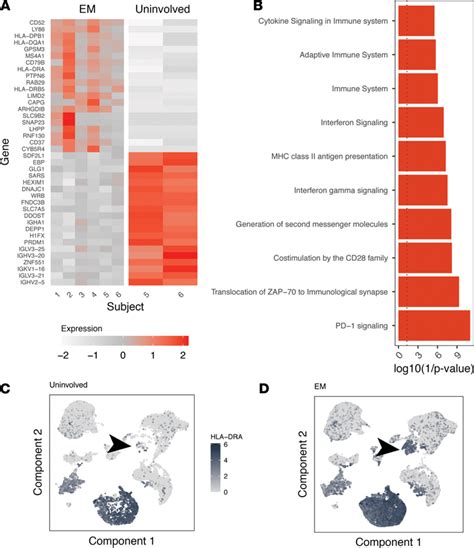 B Cells In Em Lesions Express High Levels Of Mhc Class Ii Genes And