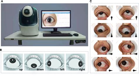 frontiers deep learning algorithm for automated detection of