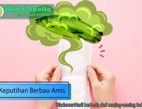 Disebabkan Infeksi Jamur Begini Cara Mengatasi Keputihan Gatal