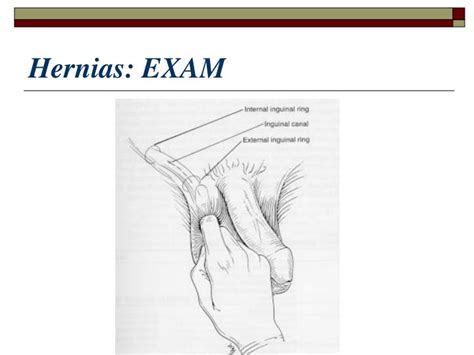 Ppt Evaluation Of Testicular Disorders Powerpoint Presentation Id