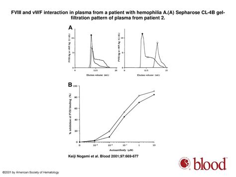 Circulating Factor Viii Immune Complexes In Patients With Type 2