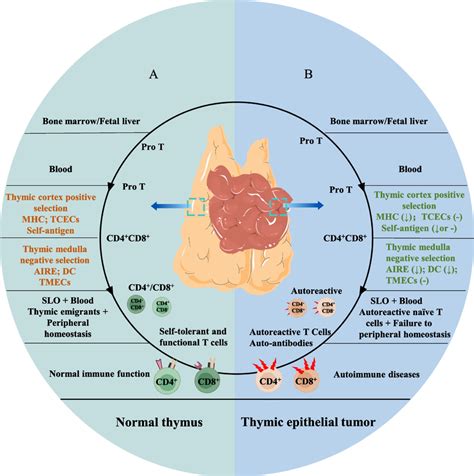 Naïve T Cell Development In The Normal Thymus And Thymoma A A Healthy