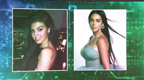 Georgina Rodríguez Antes Y Después Todas Sus Operaciones Estéticas