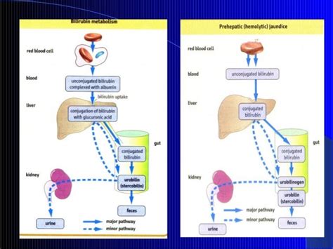 Jaundice Liver Function Tests