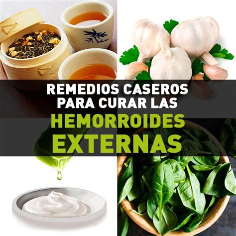 Arriba 102 Imagen De Fondo Remedios Caseros Para El Adormecimiento De