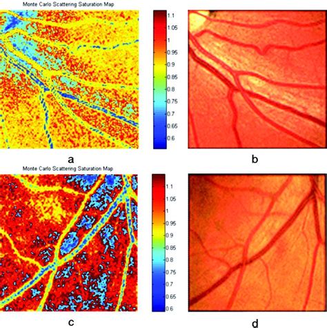 Snapshot Hyperspectral Imaging In Ophthalmology