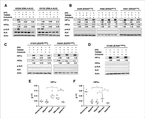 Alk Kinase Activity Regulates Hif1a And Hif2a In Nsclc Cells