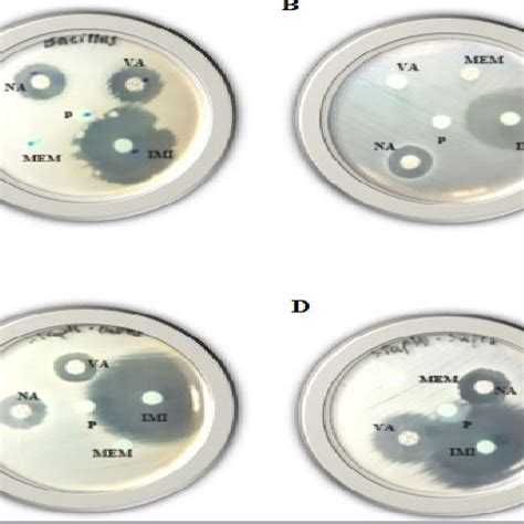 Disk Diffusion Susceptibility Test For The Gram Positive Bacteria