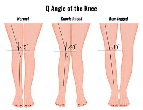 Q Angle Of The Knee Explained Knee Rehabilitation