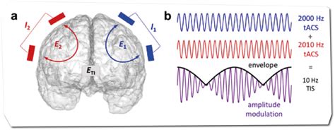 Temporal Interference Brainbox