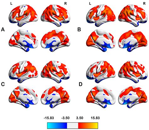 ijms free full text sex specific patterns of aberrant