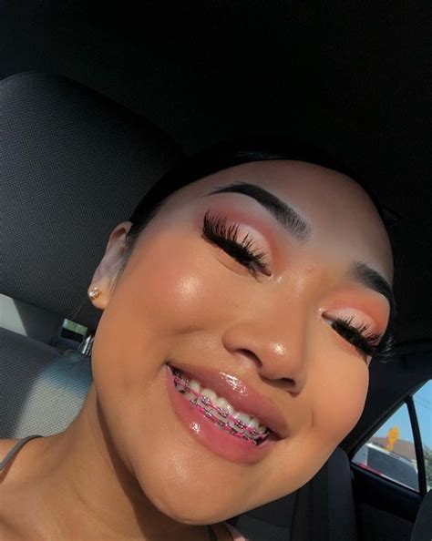 Follow Me For More 🤣 Amourrxkay Cute Braces Braces And Glasses