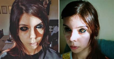 Woman Goes Blind After Having Eyeballs Tattooed Black Metro News