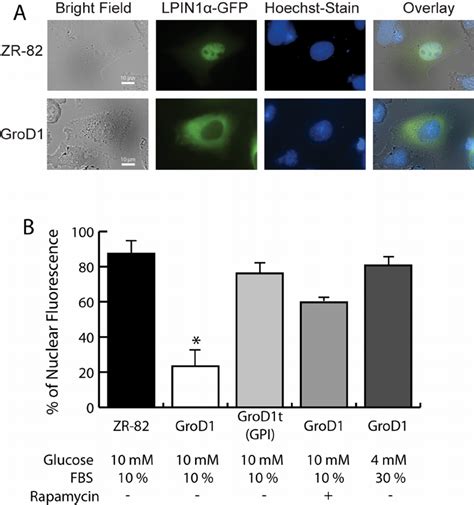 Gpi Deficiency Induces An Altered Lipin 1 Subcellular Localization