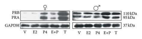 Regulation Of Pr Isoforms Protein Content By Sex Hormones In Airway