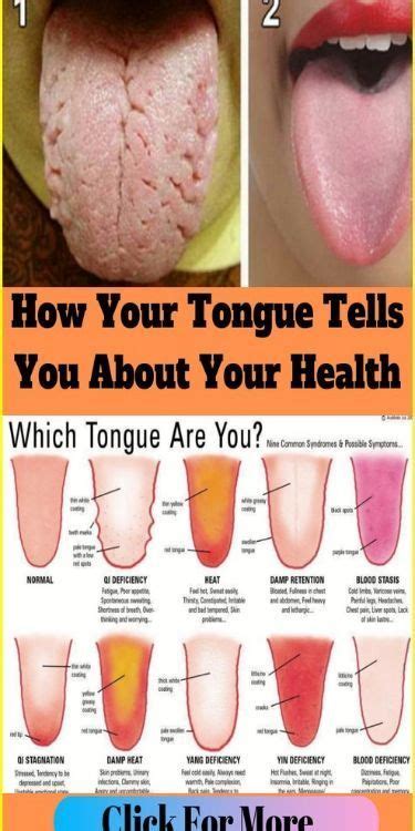 What Does Your Tongue Say About Your Health In 2024 Tongue Health