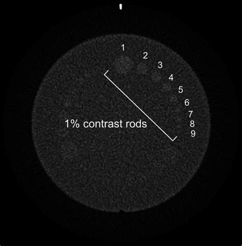 Dose Reduction And Low Contrast Detectability Using Iterative Cbct