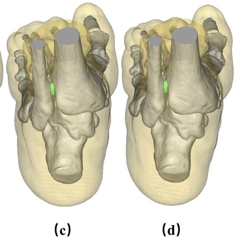 The Finite Element Model Of Each Operating Mode Before And After