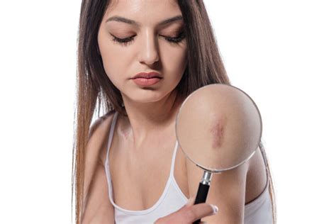 Removing Unwanted Scars With Scar Tissue Removal New Jersey