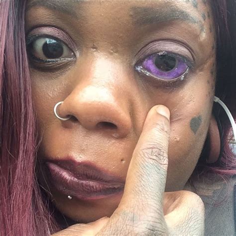 Mother Of Five Going Blind After Tattooing Her Eyeball Purple