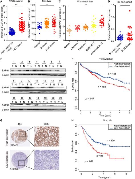 Frontiers B Cell Receptor Associated Protein 31 Promotes Metastasis