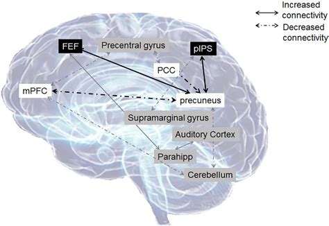 Figure 3 From Connectivity Of Precuneus To The Default Mode And Dorsal