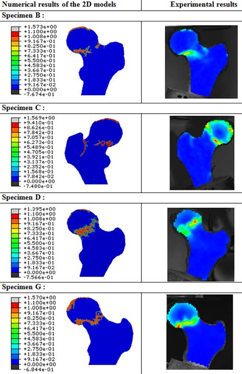 Finite Element Derived From Dxa Image And Experimental Fracture