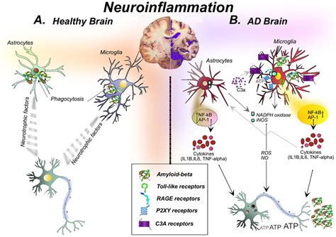 Schematic Showing The Modes Of Neuroinflammation In Healthy And Ad