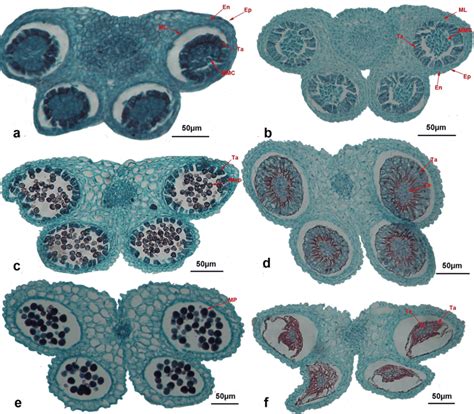 Cytological Observations Of Anther Development In Wild Type ‘ft A C