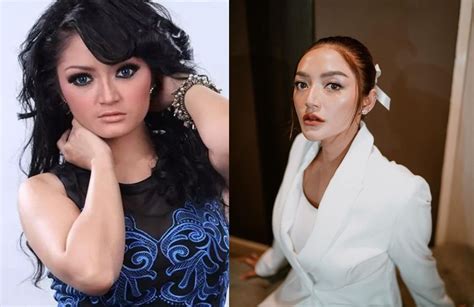 10 Transformasi Artis Sebelum Dan Sesudah Filler Bibir Ada Yang