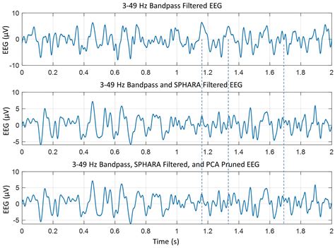 Frontiers Spatiotemporal Phase Slip Patterns For Visual Evoked