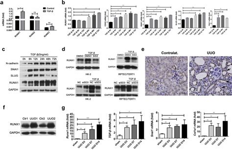 Runt Related Transcription Factor 1 Runx1 Promotes Tgf β Induced