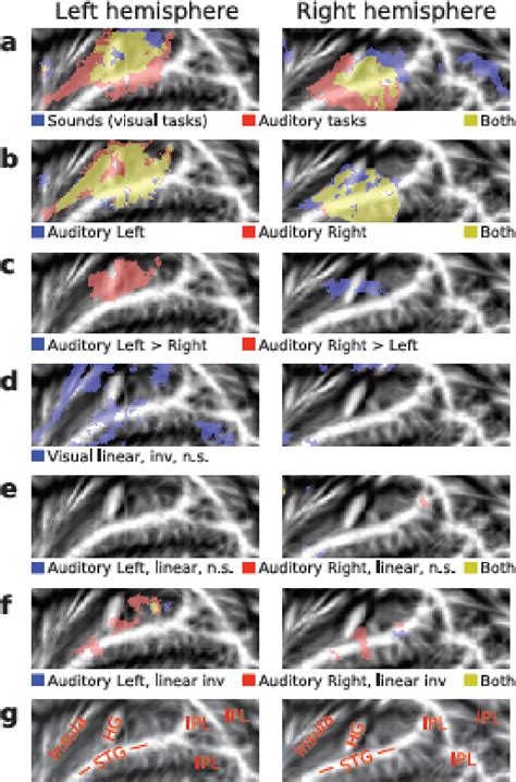 Figure 1 From Activations Of Human Auditory Cortex During Visual And