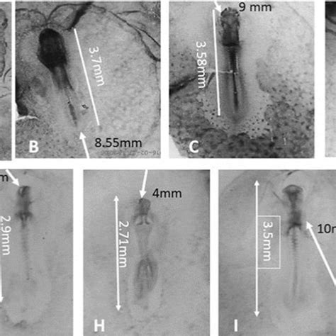 A Selection Of Typical Anomalies Of Embryos Exposed To Agar Soaked With
