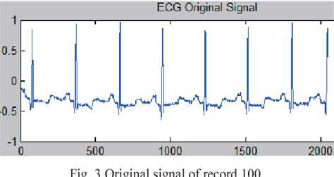 an ecg feature extraction with wavelet algorithm for personal