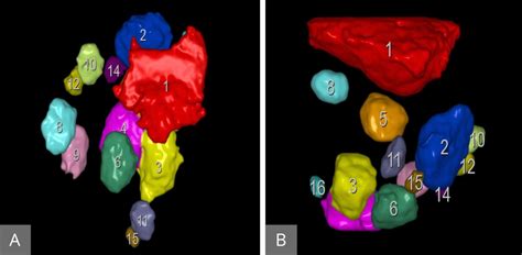 The Role Of Three Dimensional Ultrasound In Gynecology Scitemed