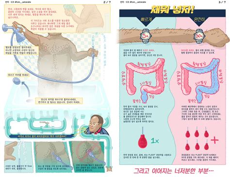 sm잡학사전 on twitter 11 애널플레이 전 필수 관장 하는법…