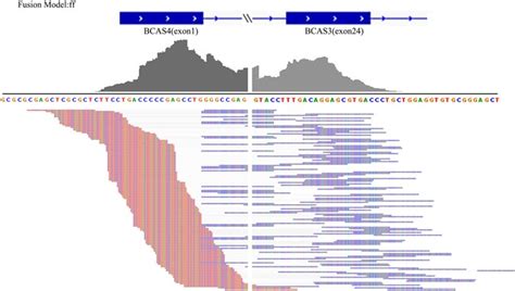 Gfusion An Effective Algorithm To Identify Fusion Genes From Cancer