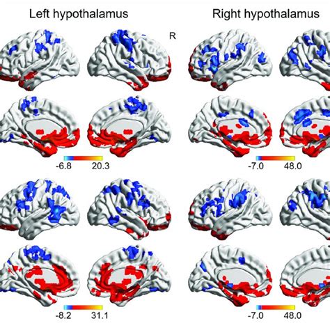Whole Brain Functional Connectivity Patterns Of Hypothalamus In Rw