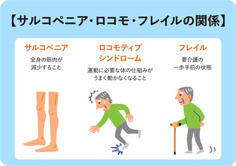 筋肉トレーニング と サルコペニアとフレイルの関係 上社眼科