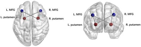 Frontiers Altered Dynamic Functional Network Connectivity In Drug