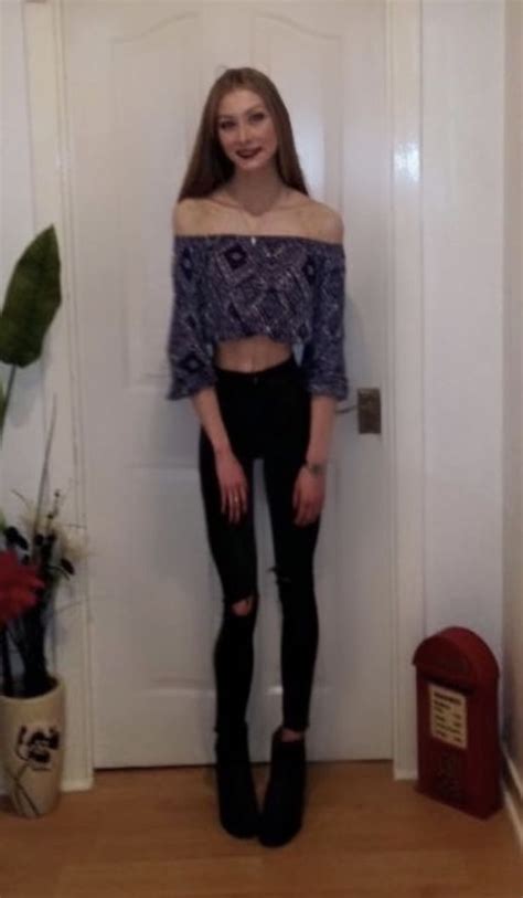 Anorexia Survivor Goes From 5st To Bodybuilder And Now Exposes Trolls
