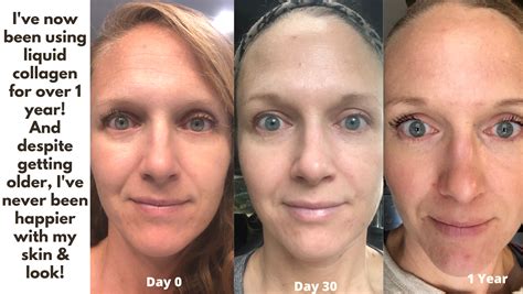 Does Liquid Collagen Really Work My Personal Review Before And After