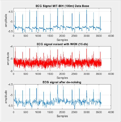 represent the ecg signal the noisy signal and the denoise signal